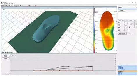 上海九院王金武教授团队：轻度代偿性脊柱侧凸可以通过3d打印矫形鞋垫矫正 3d科学谷
