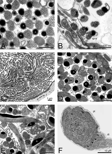 Aec Echinothrips Americanus A Cross Section Through Mature