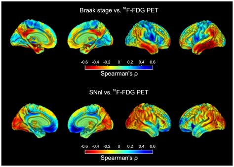 Differential Effects Of Tau Stage Lewy Body Pathology And Substantia