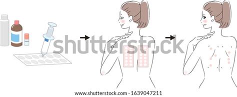 Procedure Women Take Patch Test Stock Vector Royalty Free Shutterstock