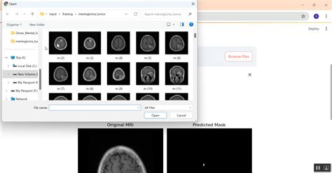 Brain Mri Image Segmentation In Python Projects