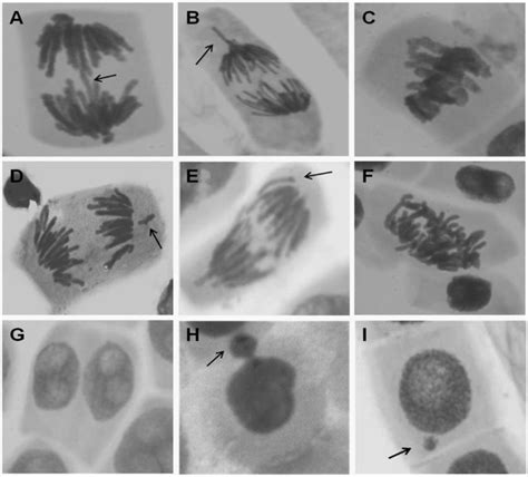 Most Common Chromosomal And Nuclear Aberrations Cnas Observed In The