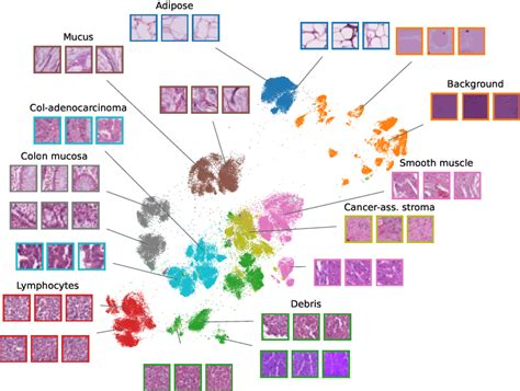 Figure From Self Supervised Visualisation Of Medical Image Datasets Semantic Scholar