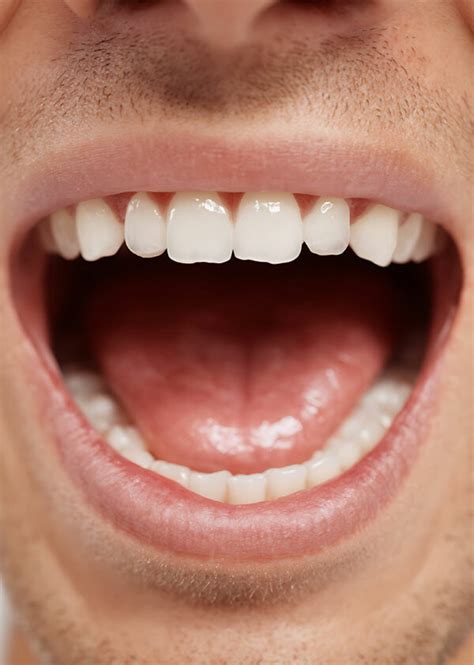 Glossectomy Advanced Ent Care