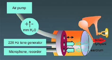 The Elements Of Tympanometry The Impedance Of The Eardrum Is Sensed By