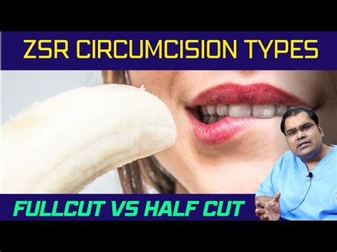 Types Of Circumcision Cuts