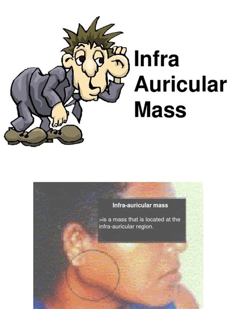 Infra Auricular Mass Case Presppt Blood Cell Blood