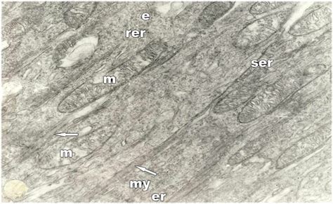 Electron Micrograph Of The Inner Segments Of Photoreceptor Of Control