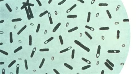 Spore Forming Bacteria Ask Microbiology