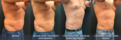 Bad Love Handles