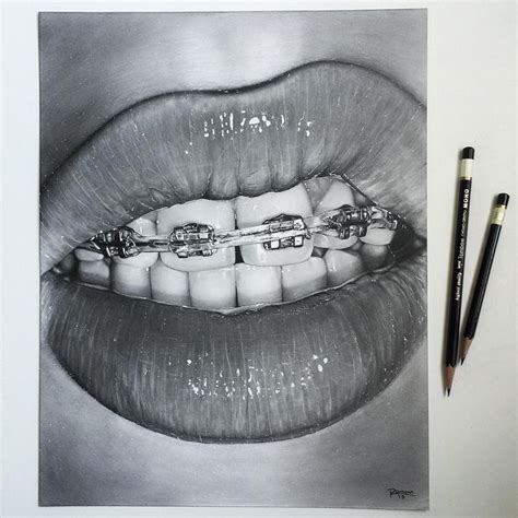 How To Draw A Mouth With Braces Step By Step