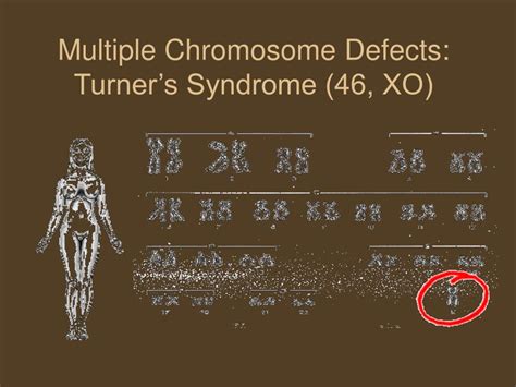 Ppt Errors And Exceptions In Chromosomal Inheritance Powerpoint Presentation Id6730685