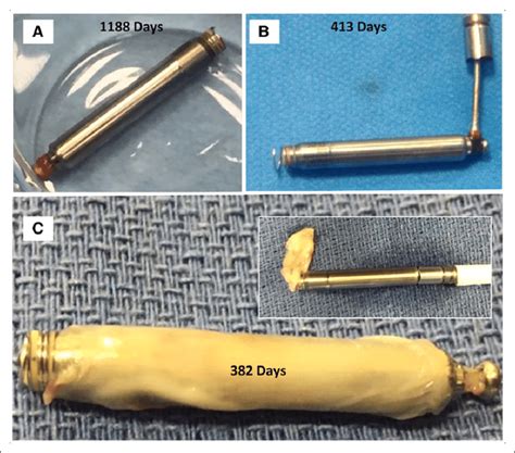 A And B Examples Of Extracted Leadless Pacemakers Demonstrating