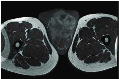 Mri T1 Axial Section Download Scientific Diagram
