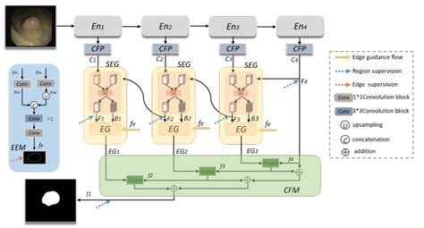 Segt Separated Edge Guidance Transformer Network For Polyp Segmentation