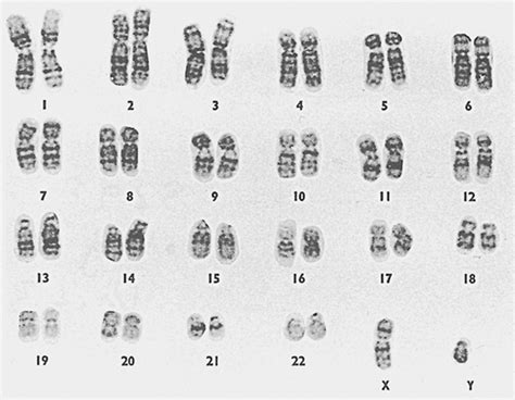 All About Chromosomes Openlearn Open University