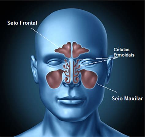 Os Seios Maxilares E Sua Relevância Para O Cirurgião Dentista Lúmax