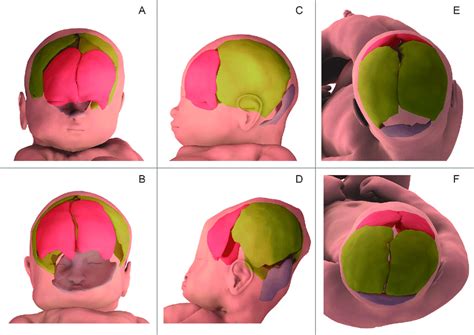 Three Dimensional Finite Element Reconstruction Of The Cranial Bones Download Scientific