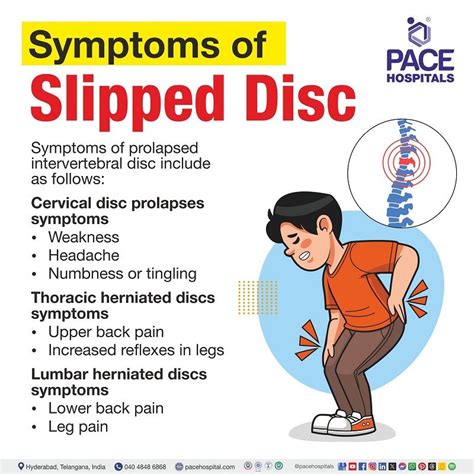 Slipped Disc Herniated Disc Causes Symptoms And Treatment