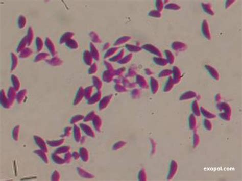 Toxoplasma Gondii Pregnancy