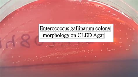 Enterococcus Gallinarum Colony Morphology On Cled Agar Of Urine Culture Youtube