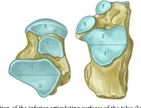Figure 1 From Mri Classification Of Subtalar Joint Osteoarthritis Using A Novel Scoring System