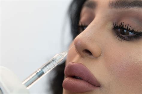 Non Surgical Rhinoplasty The London Cosmetic Clinic