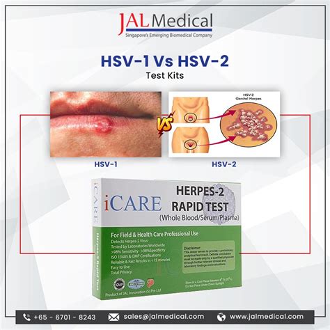 Jal Medical Singapore Pte Ltd On Linkedin Browse Reliable Hsv Testing Kits From Jal Medical