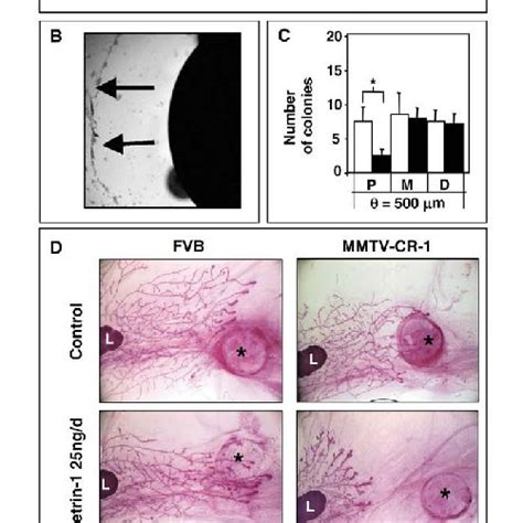 Expression Of Netrin 1 And Its Receptors Neogenin And Unc5h1 In Mouse Download Scientific