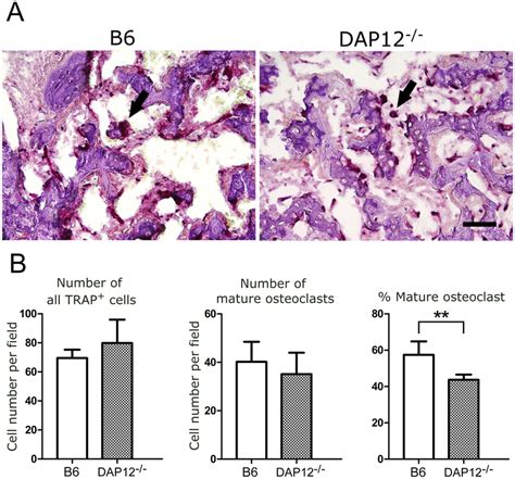 Histochemical Analysis For Trap Staining Histochemical Analysis For Download Scientific