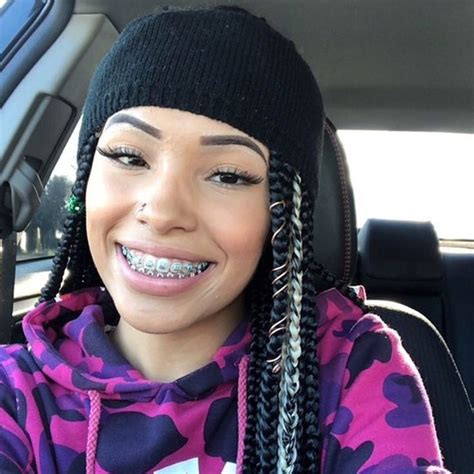 Pinterest Tastydoll🍭 Follow For More Braces Girls Cute Braces Colors Cute Braces