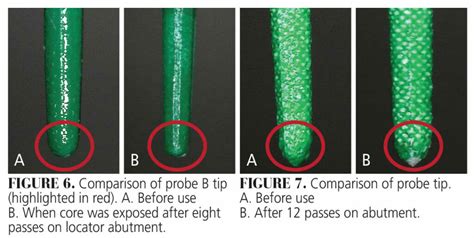 The Impact Of Dental Probe Wear On Implant Health Decisions In Dentistry