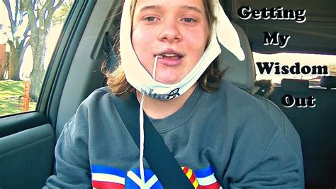 I Got My Wisdom Teeth Out And Im Back Youtube