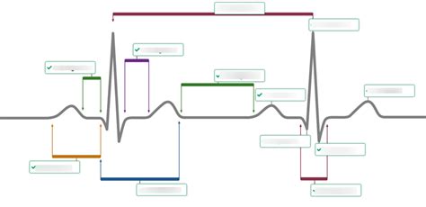 Ecg Lab Diagram Quizlet