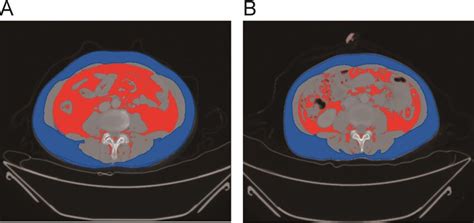 Visceral Fat Area Subcutaneous Fat Area And Total Fat Area Were Download Scientific Diagram
