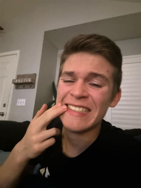 Yooooo Got My Braces Off Rteenagersbutbetter