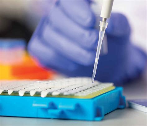 Gsd Nueva Marca De Un Grupo Líder En Kits Diagnósticos