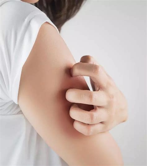 Hyperpigmentation On Buttocks Causes Treatment And Prevention