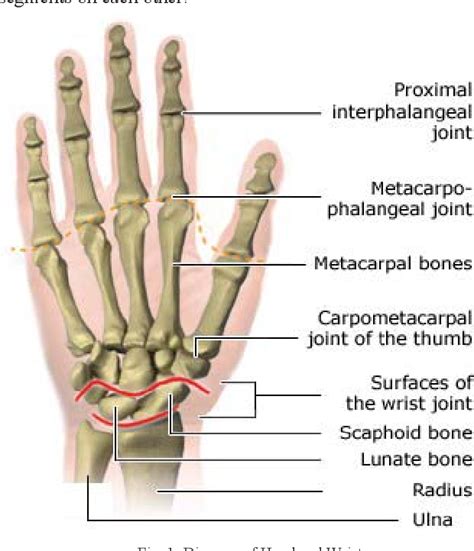 Figure 1 From A Low Cost Bionic Arm Based On Electromyography Sensor