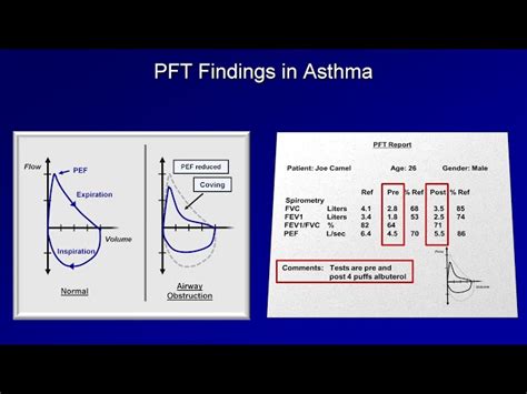 Spirometry Test Asthma