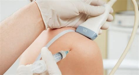 Steroid Injections In Shoulder Pros And Cons Sport Doctor London