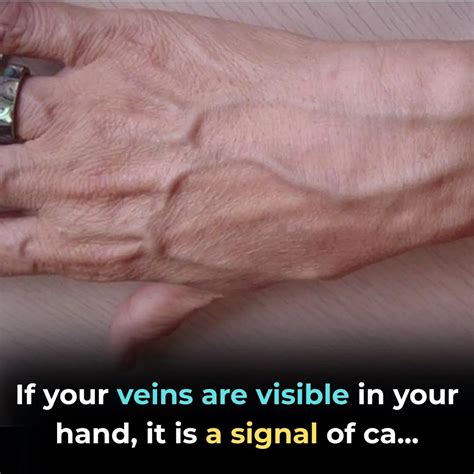 Visible Veins Explained Normal Causes Health Risks And When To Worry
