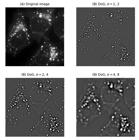 Spot Detection — Day 2 Intro To Bioimage Analysis With Python For Life