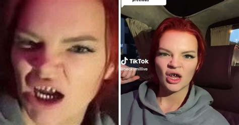 My Precious Onlyfans Model Wins Internet With Gollum Impression As She Files Teeth For Veneers