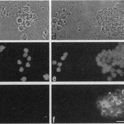 Electron Microscopy Of Leukocyte Endothelium Interaction After