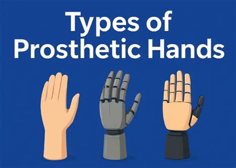 Prosthetic Hands Cost In India Types And How They Work 2025 Guide