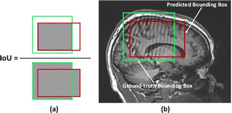 Figure 5 From Localized Motion Artifact Reduction On Brain Mri Using