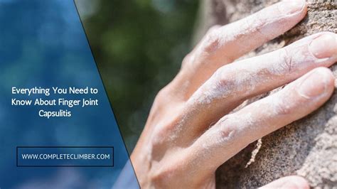 Everything You Need To Know About Finger Joint Capsulitis