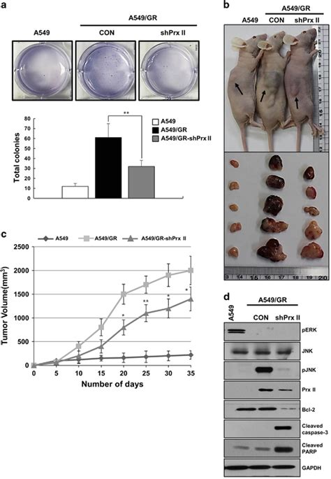 Peroxiredoxin Ii Prx Ii Expression Is Essential For Tumor Growth Of