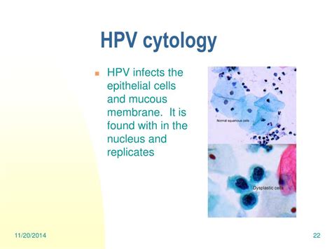 Ppt Hpv Prevention Screening And Management Powerpoint Presentation